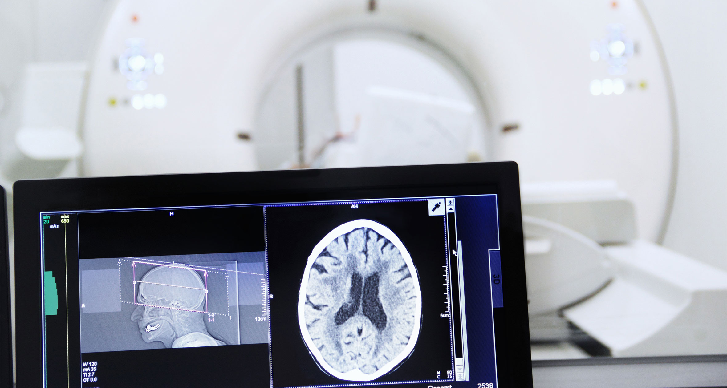 Twin Studies Support Stereotactic Radiosurgery as Standard Practice ...