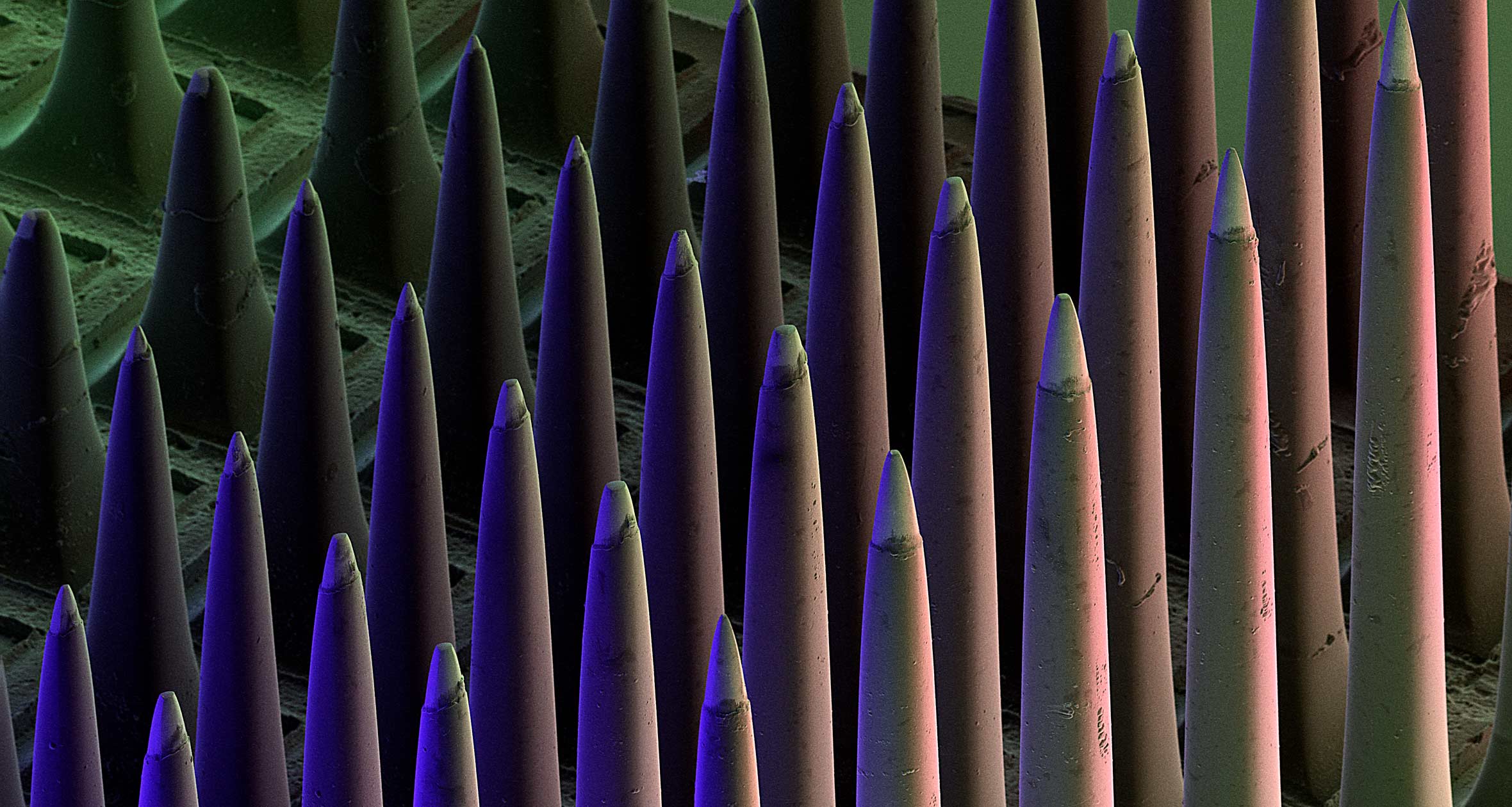Implantable Device Monitors Seizures | NYU Langone Health Physician Focus