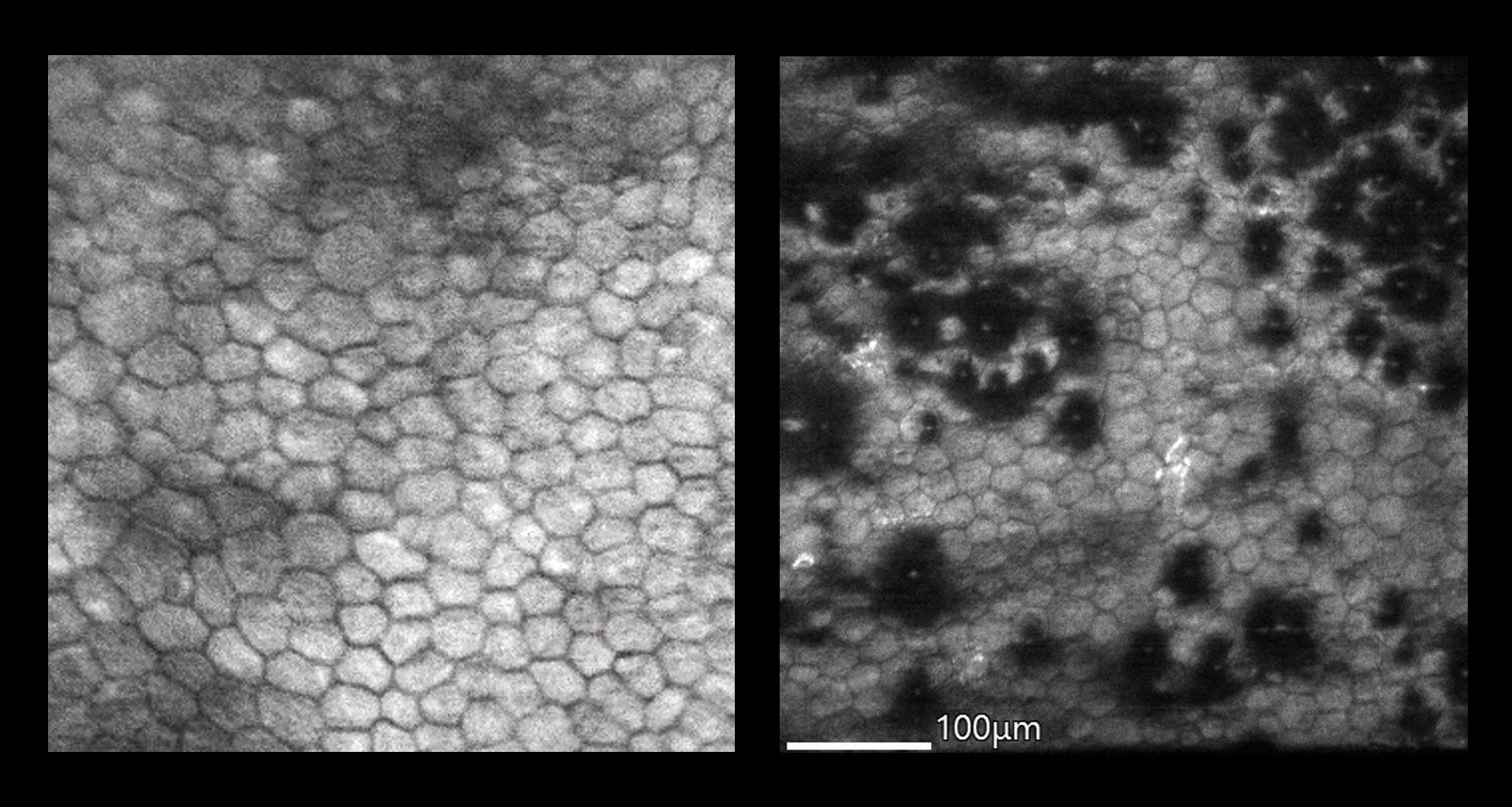 Capturing a Complete View of the Cornea | NYU Langone Health Physician ...