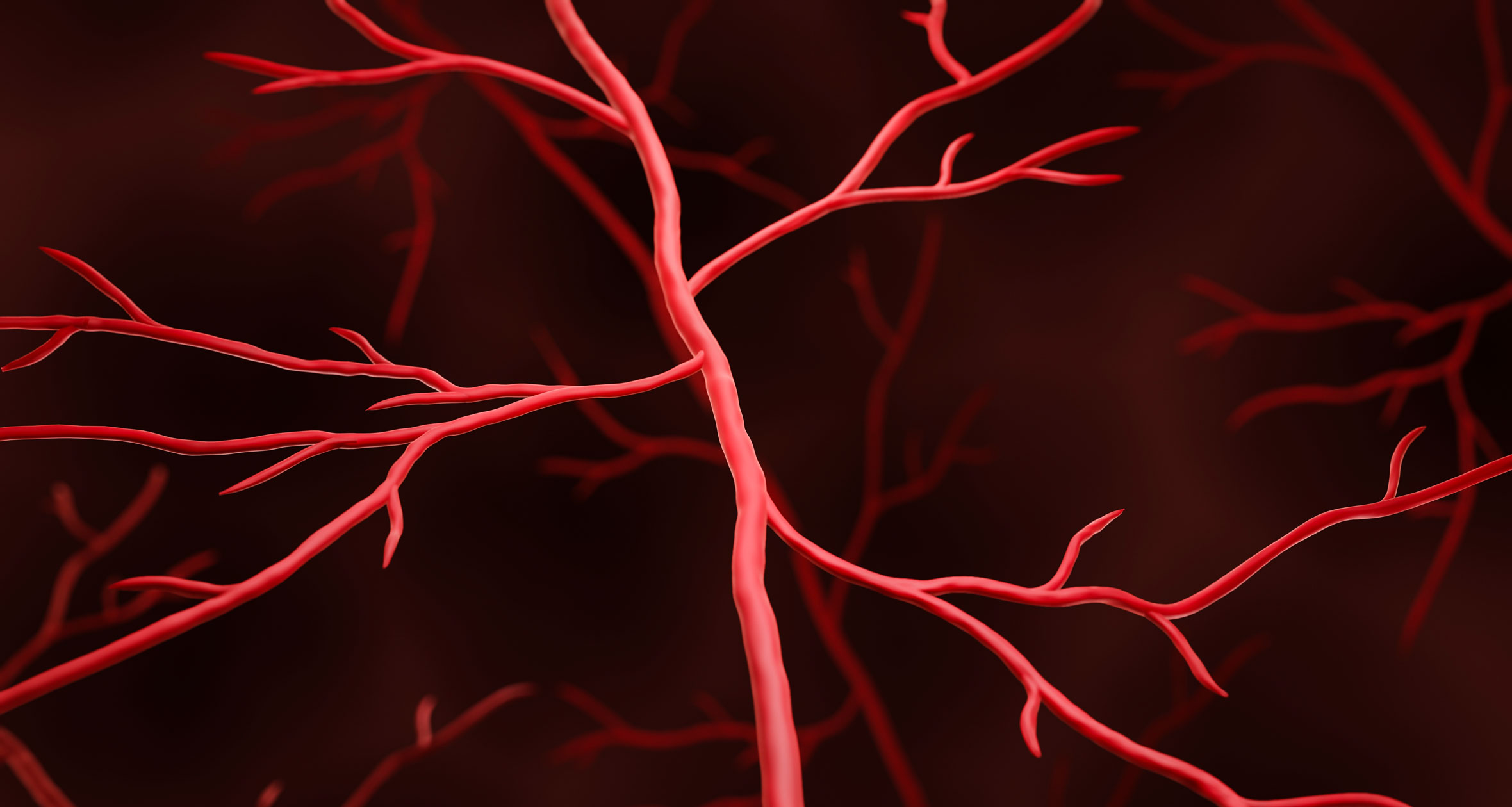 Mondor’s Disease: A Case Report & Overview of the Rare Condition | NYU ...