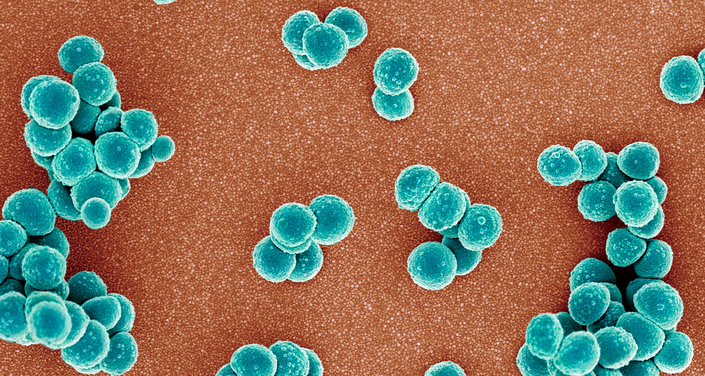 System-Wide Quality Council Rolls Out Nasal Decolonization and ...